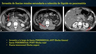 ANATOMIA DE RETROPERITONEO GASTROENTEROLOGIA | PPTX