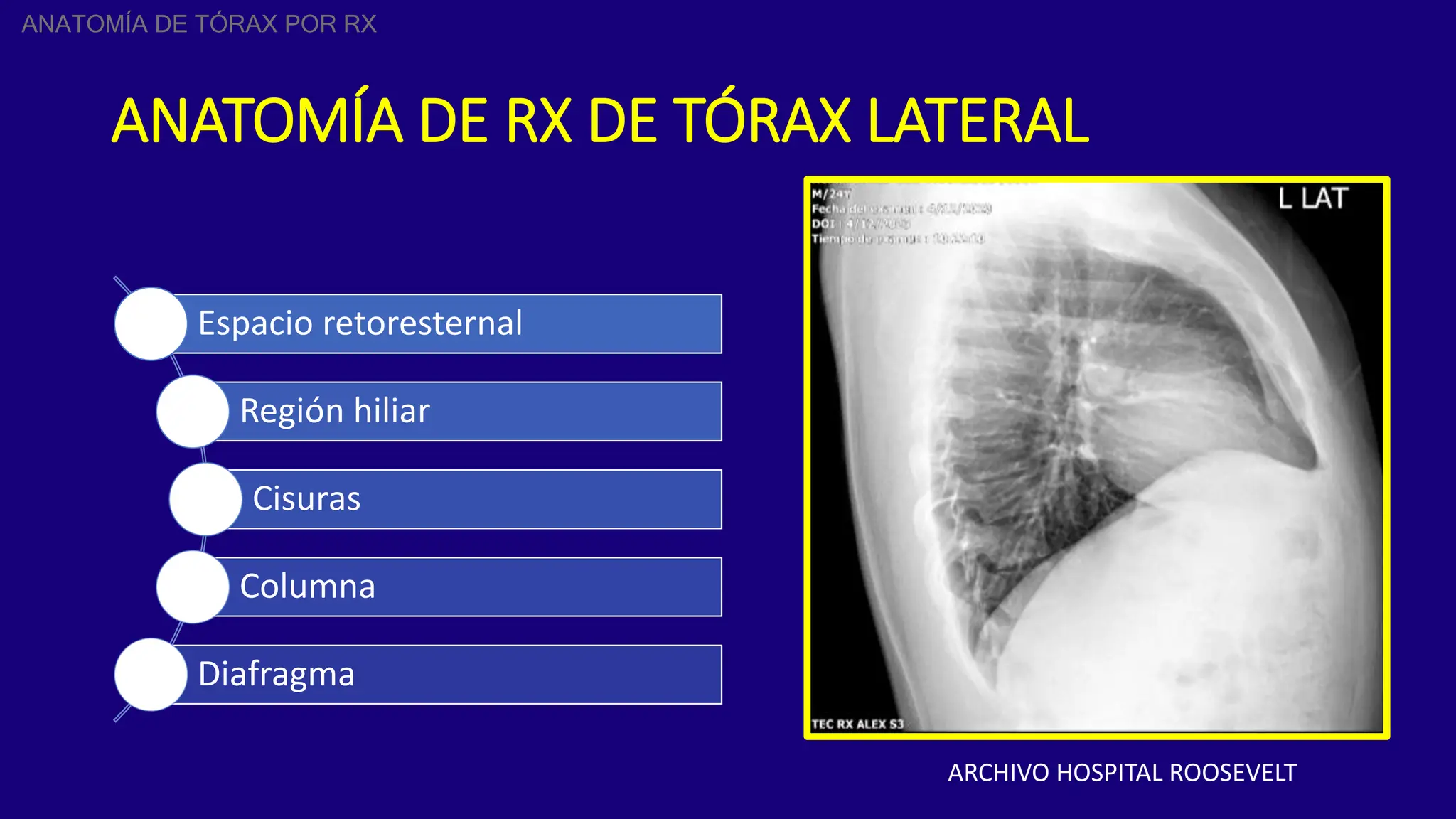 ANATOMÍA DE RX DE TÓRAX - esteban.pptx