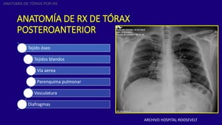 ANATOMÍA DE RX DE TÓRAX - esteban.pptx