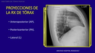 ANATOMÍA DE RX DE TÓRAX - esteban.pptx