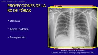 ANATOMÍA DE RX DE TÓRAX - esteban.pptx
