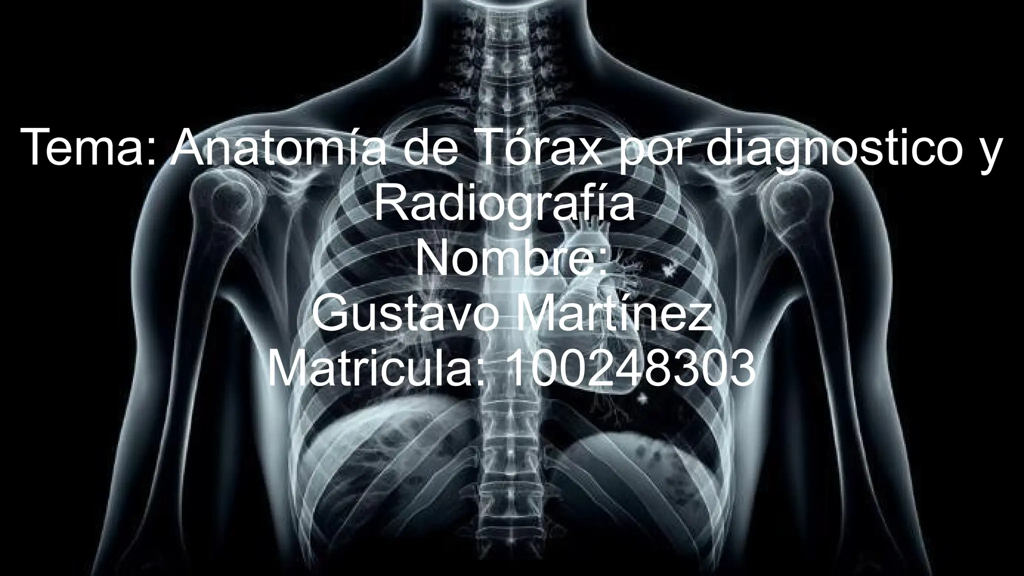 Anatomía de tórax por Diagnostico y Radiografia.pptx
