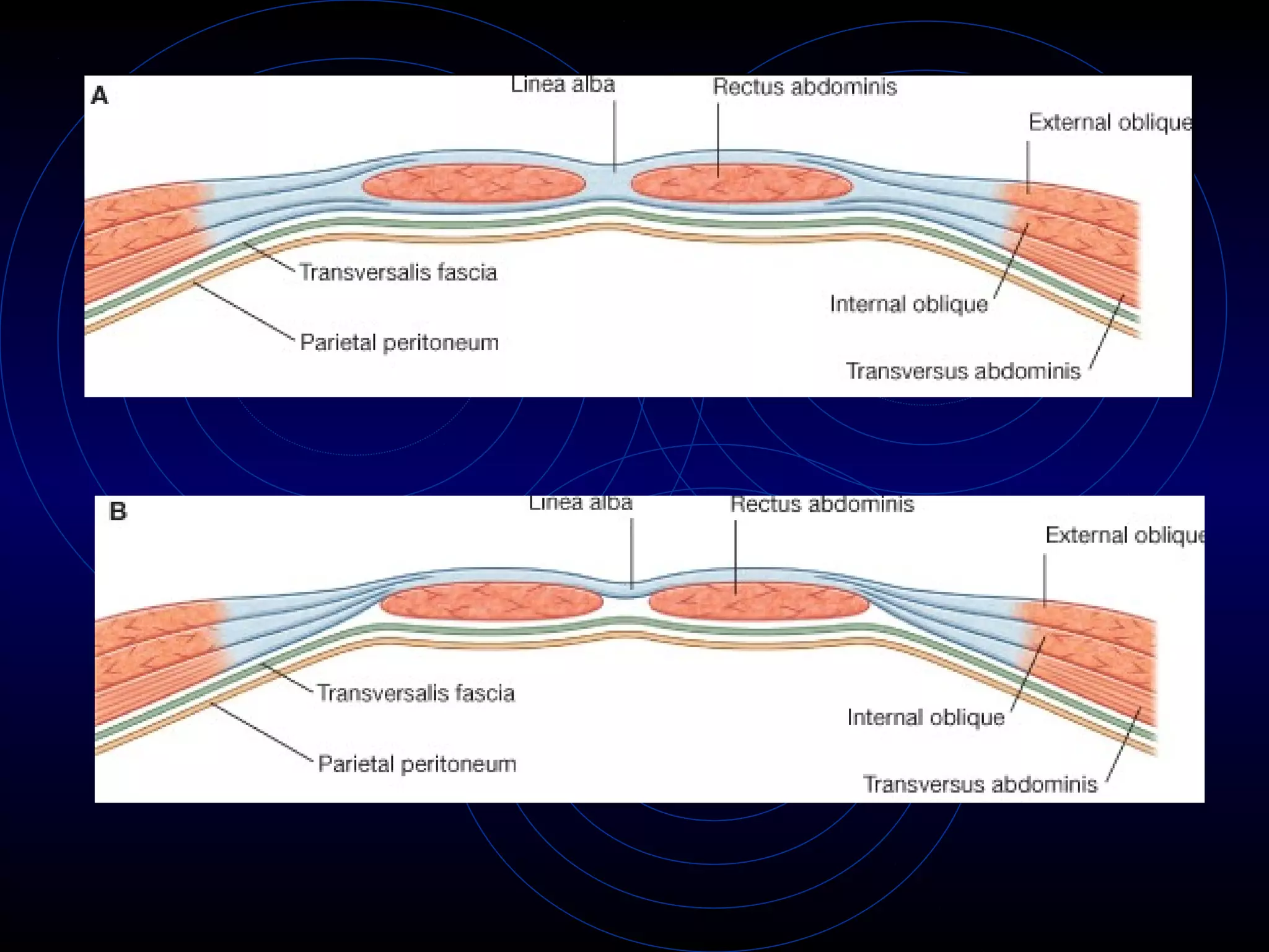 Anatomia do Abdome e Região Inguinal | PPT