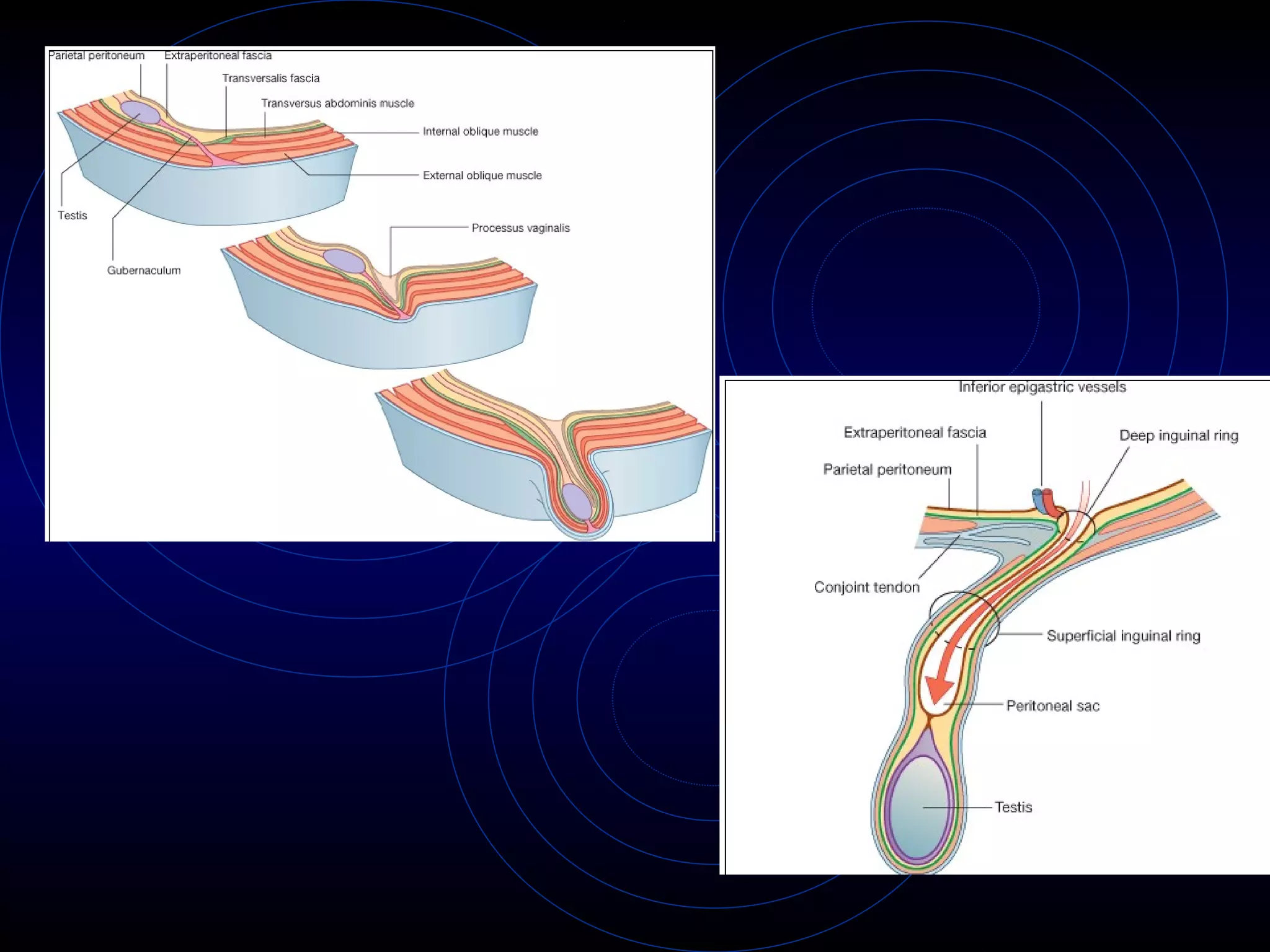 Anatomia do Abdome e Região Inguinal | PPT