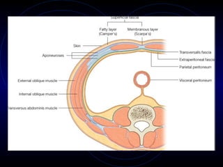 Anatomia do Abdome e Região Inguinal | PPT