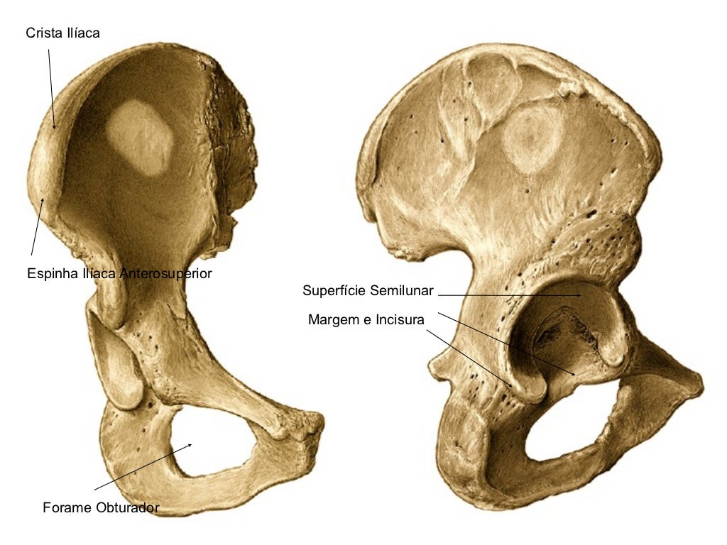 Osso Do Quadril Sem Rotulo