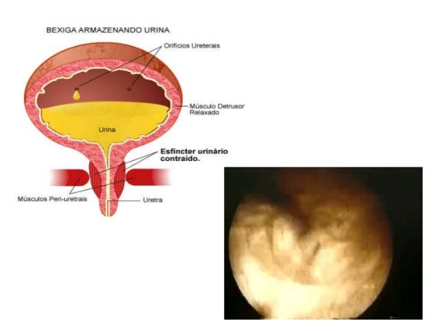 Anatomia e fisiologia vesical