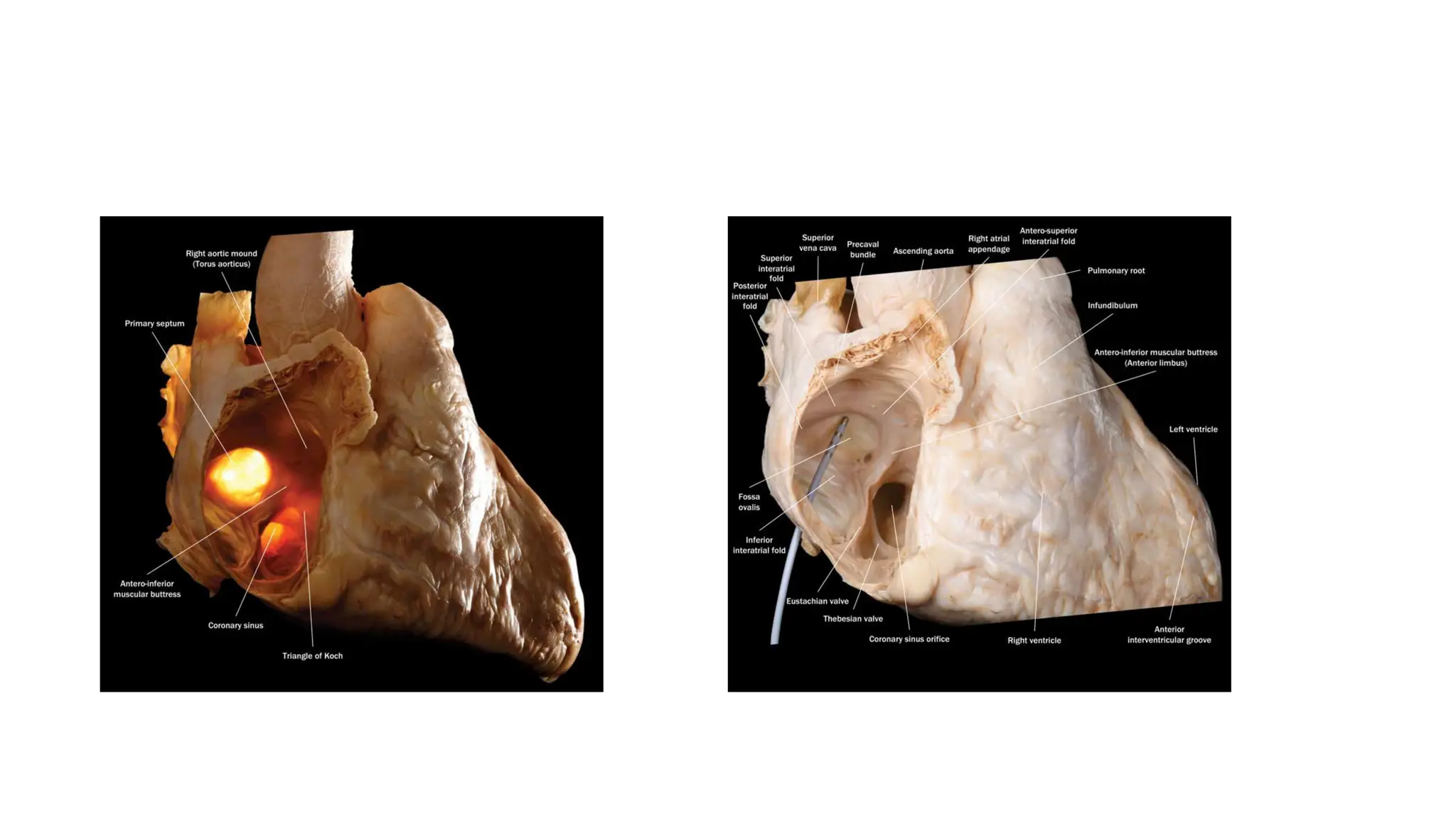 ANATOMIA E HISTOLOGIA DE LAS CÁMARAS CARDIACAS Y.pptx