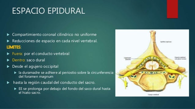 Anatomia espacio epidural
