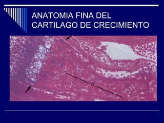 Anatomia fina del cartilago de crecimiento | PPT