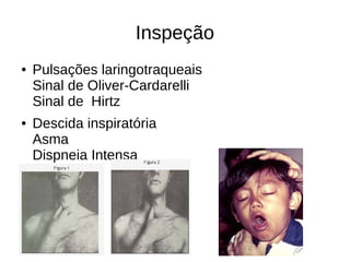 Anatomia, fisiologia e propedeutica de faringe e laringe | PDF