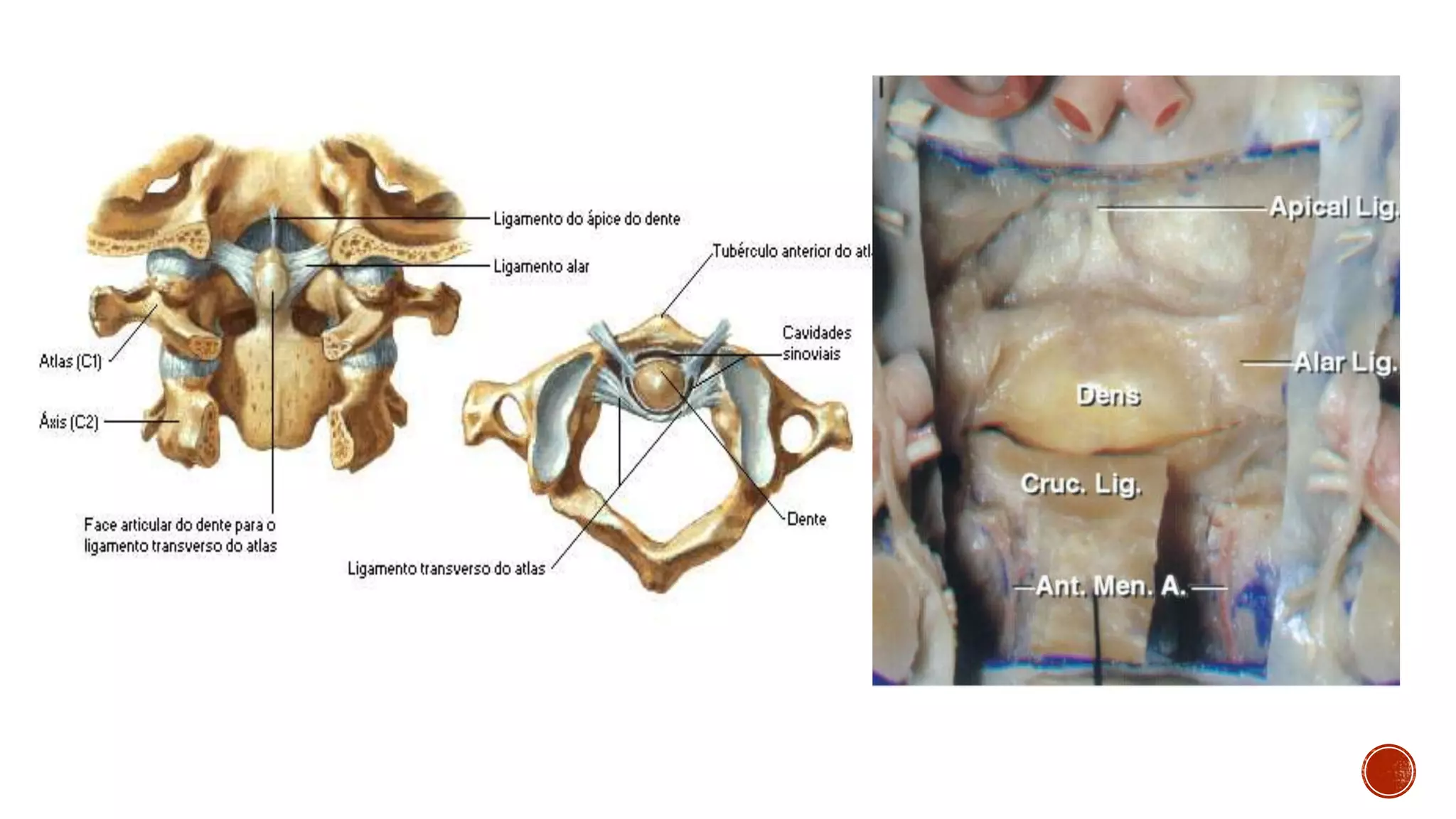 Anatomia do forame magno | PPTX