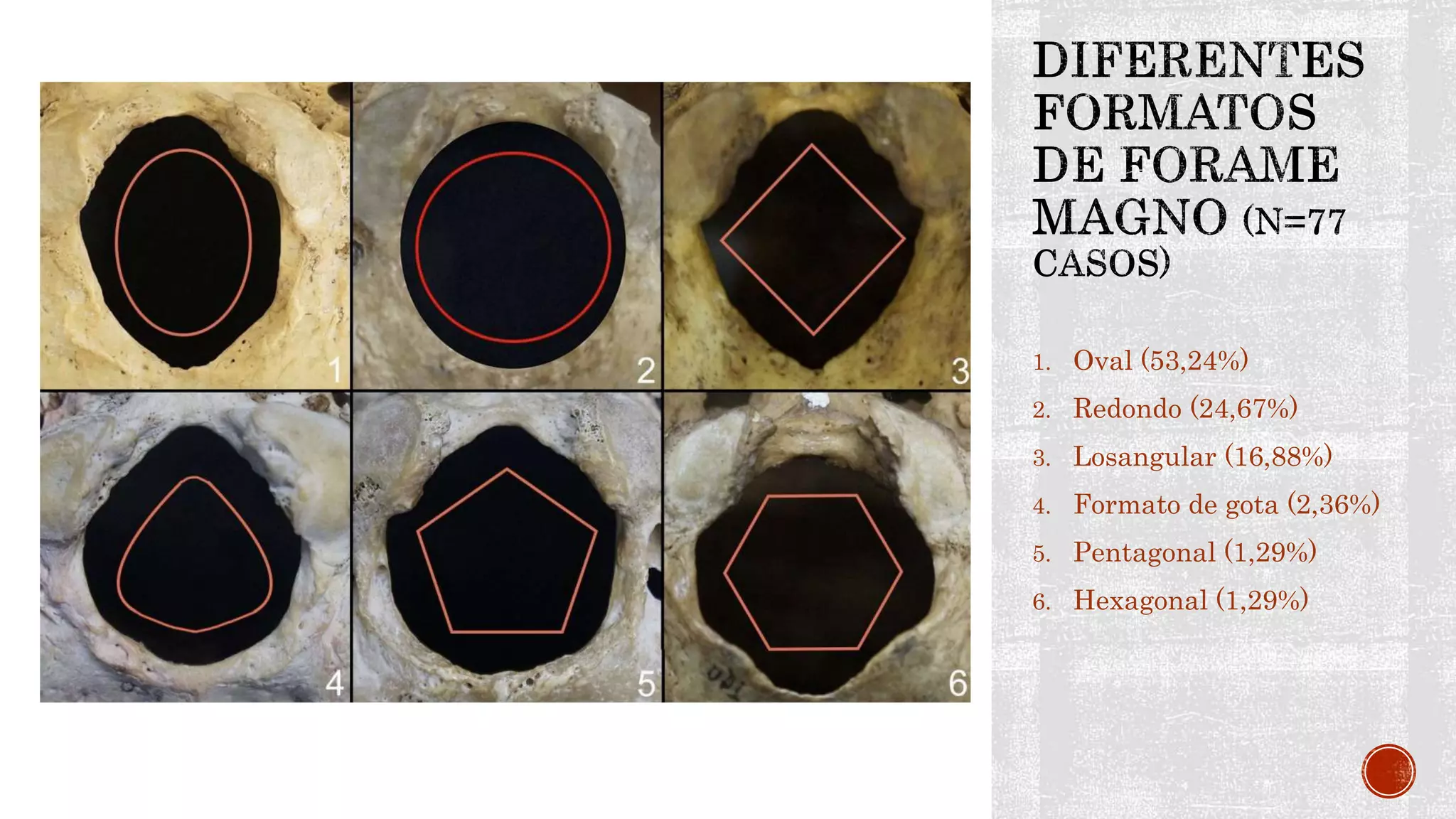 Anatomia do forame magno | PPTX