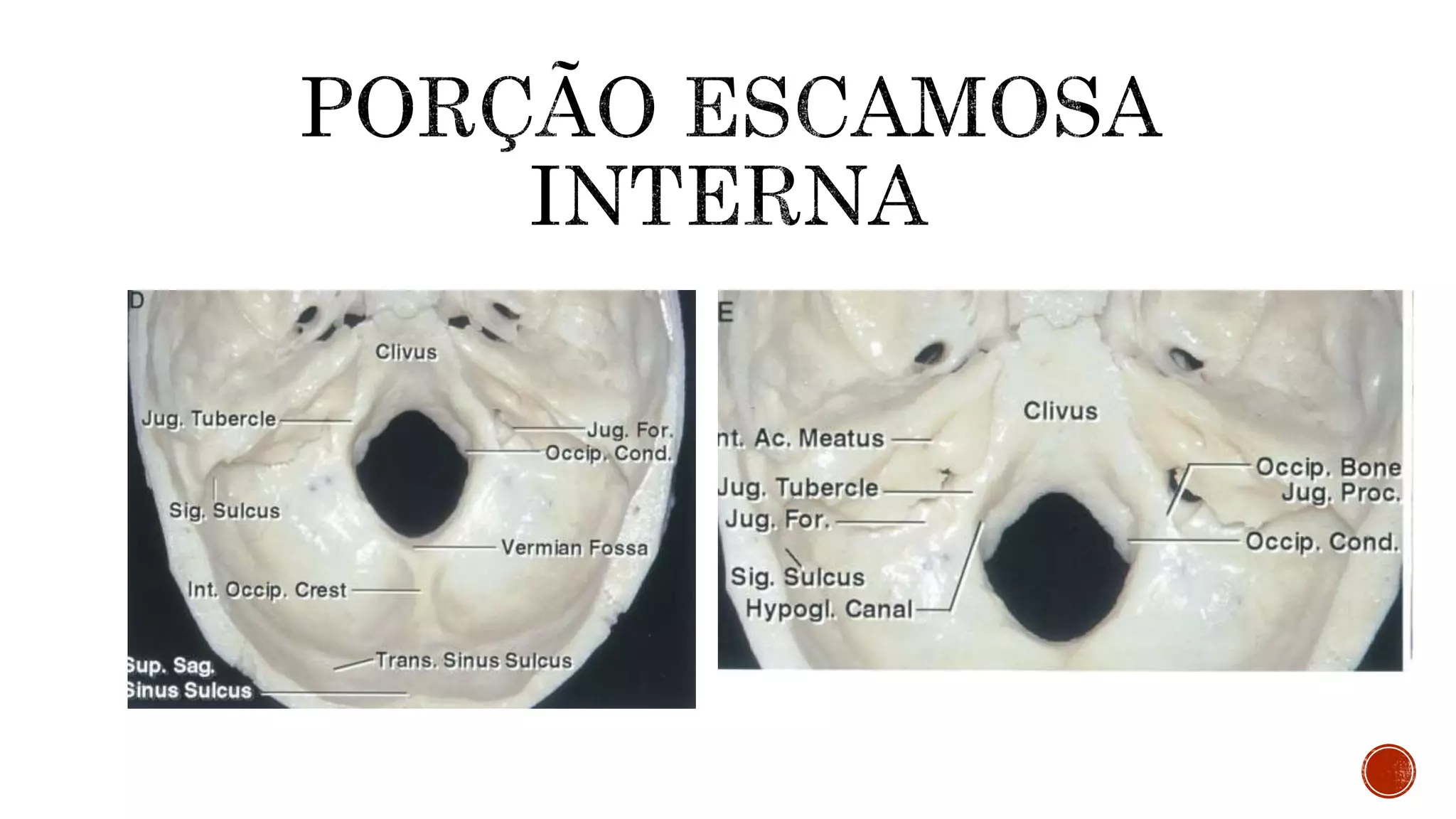 Anatomia do forame magno | PPTX