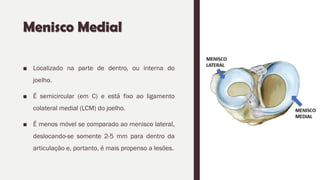 Anatomia Funcional do joelho.pdf
