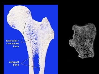 General anatomy of bones | PPT