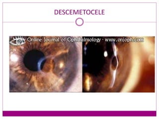 Anatomia globo ocular | PPTX