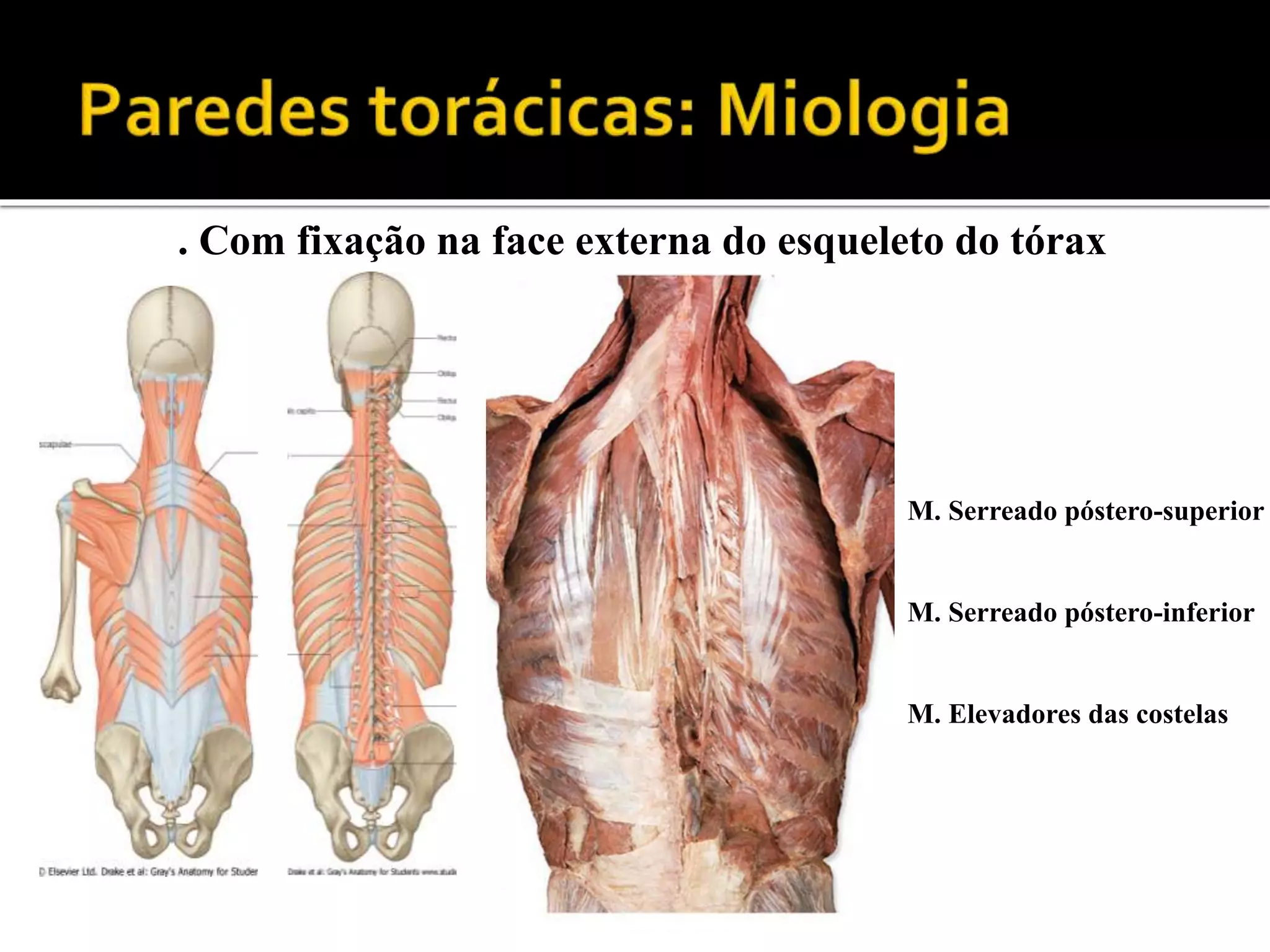 Human Anatomy |6 Thoracic Walls And Breast ; Anatomia Humana |6 paredes ...