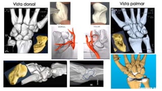 ANATOMIA MUÑECA.pptx
