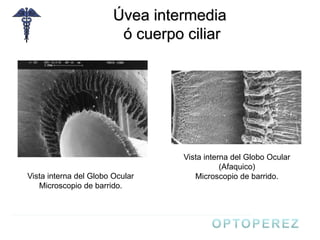 ANATOMIA OCULAR HUMANA Y POSIBLES PATOLOGIAS | PPT