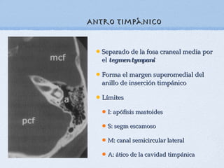 Anatomía de Oído | PPT