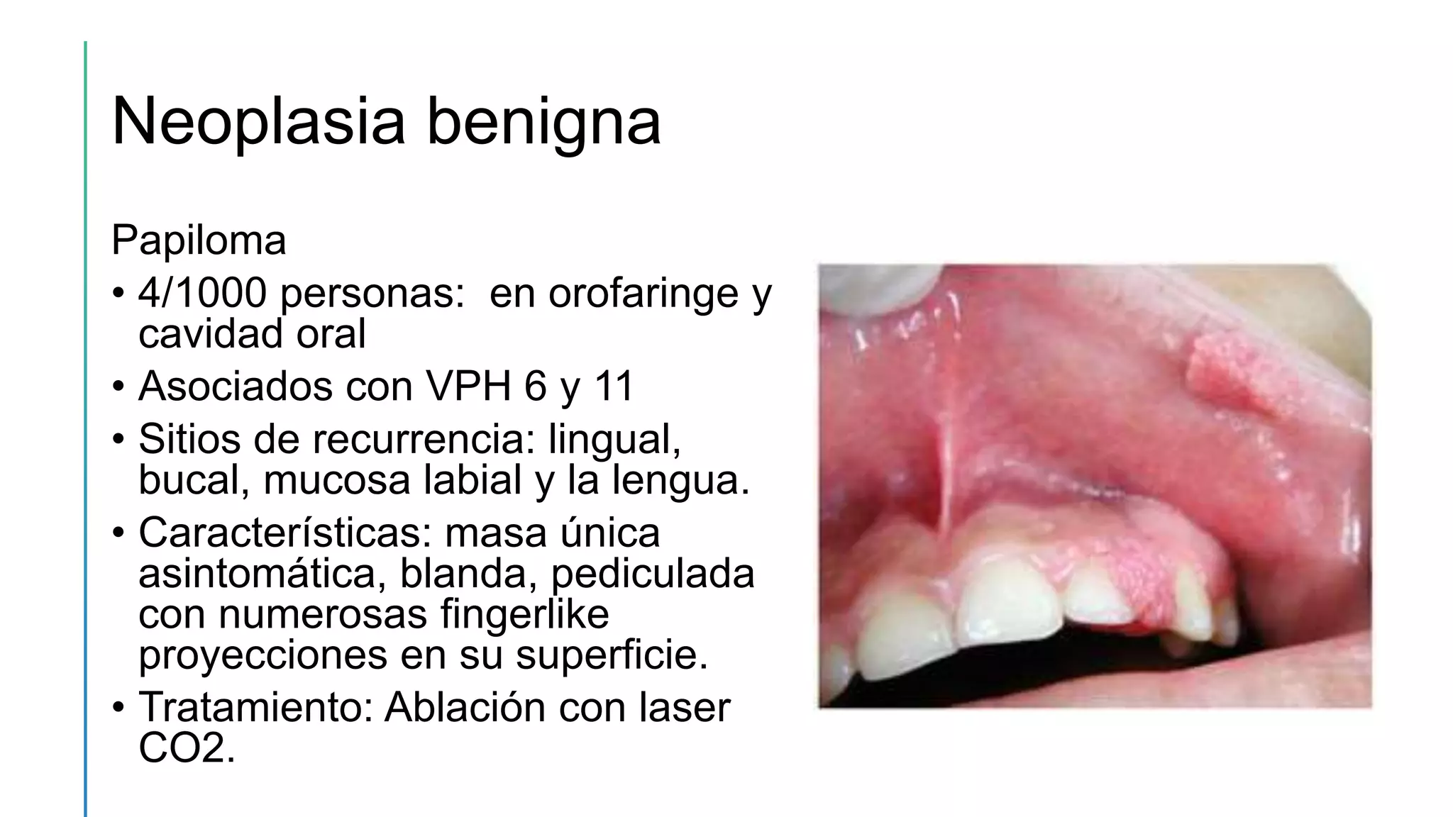 Anatomía, patología de faringe, cavidad oral.pptx