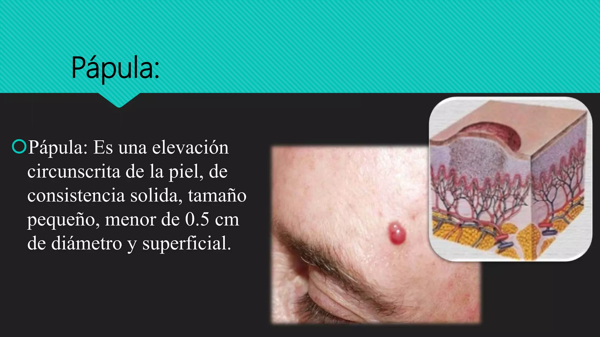 Anatomia patologica / la piel | PPTX | Skin and Dermatology | Diseases ...