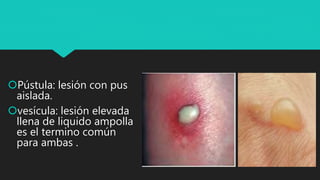 Anatomia patologica / la piel | PPTX
