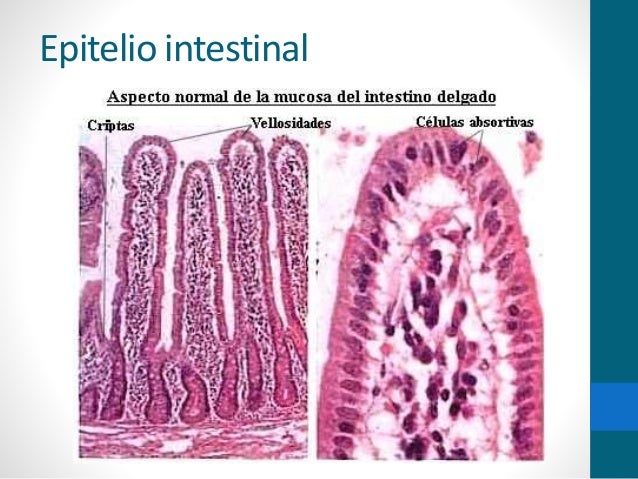 Anatomia patologica instestino delgado