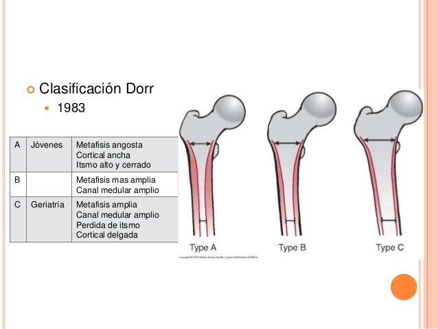 Anatomia de pelvis y cadera