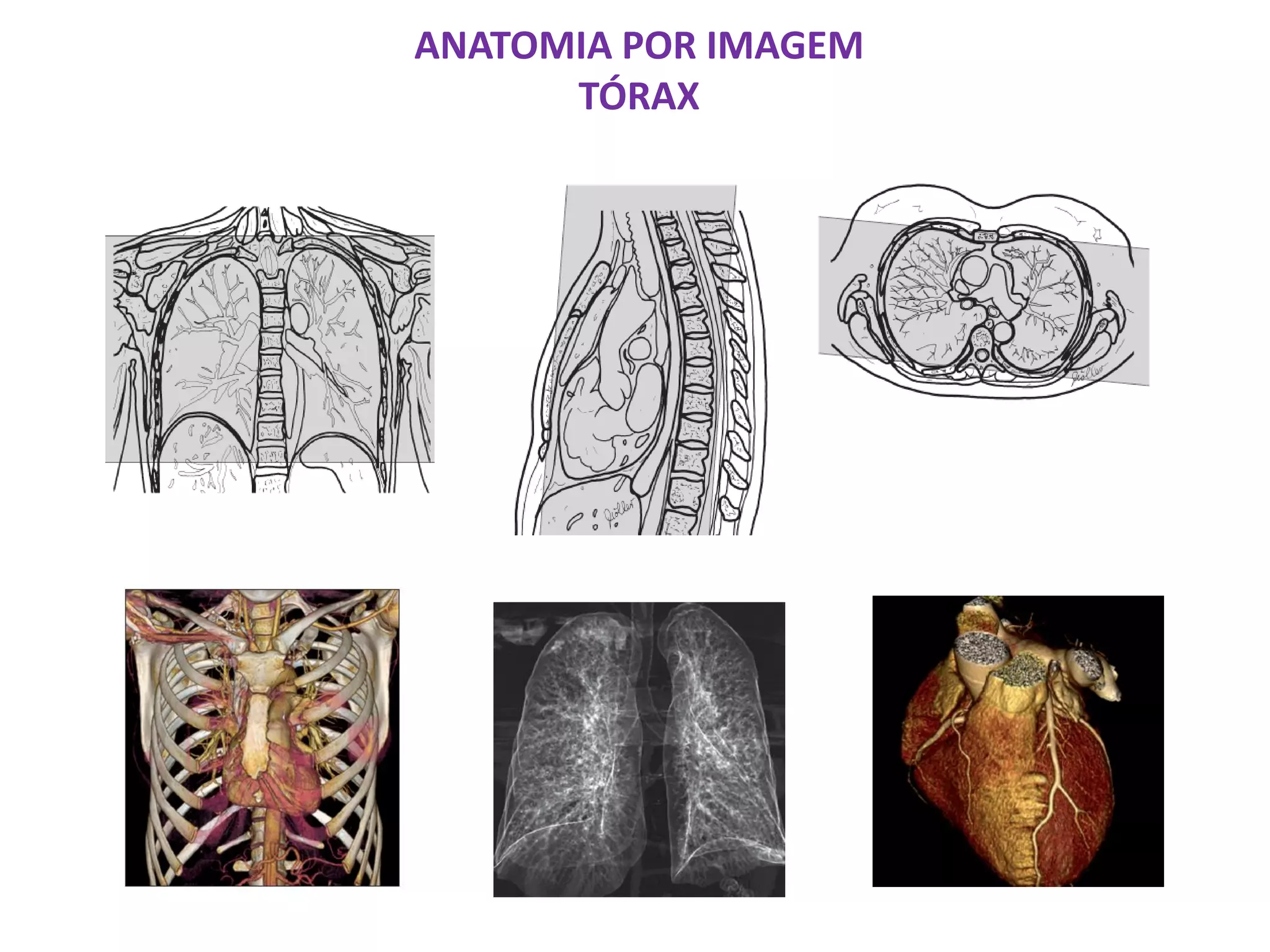 Anatomia Tórax TC RM | PPT