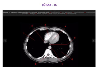 Anatomia por Imagejnm - Torax(Rogério Natal) (2).pdf