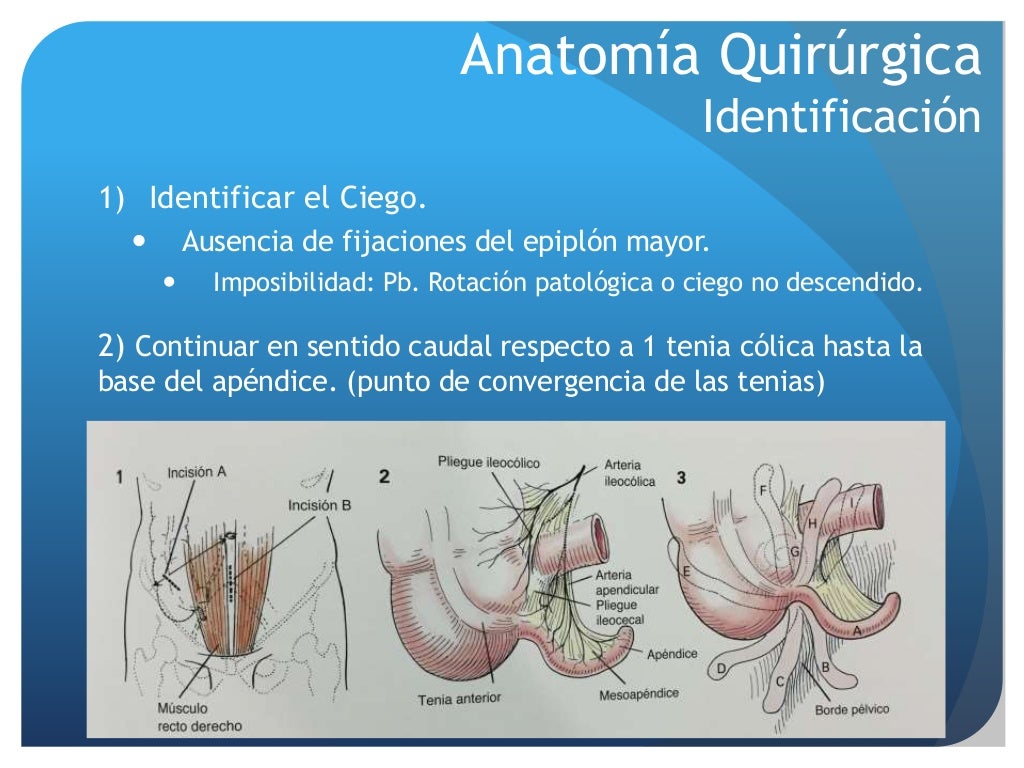 Anatomía quirúrgica apéndice cecal