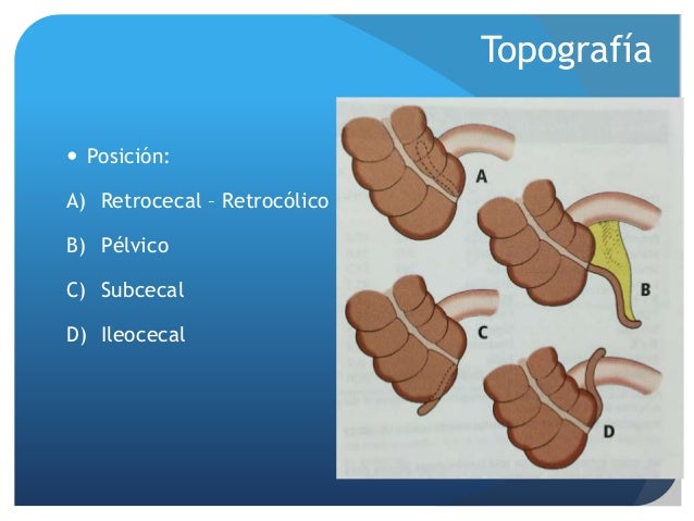 Anatomía quirúrgica apéndice cecal