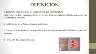 Anatomia quirurgica de la Hernia Epigastrica y Umbilical.pptx
