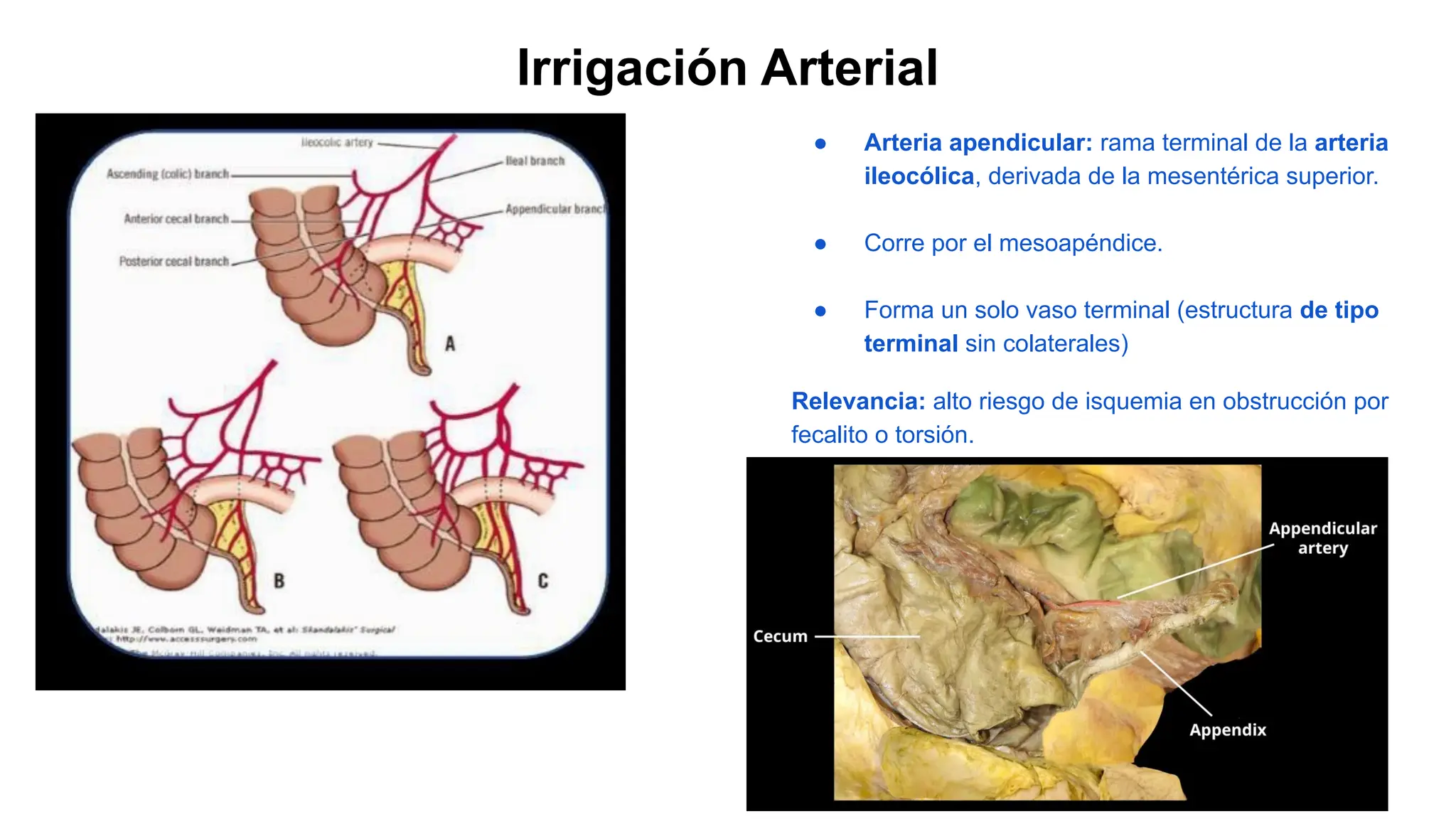 ANATOMÍA QUIRÚRGICA DEL APÉNDICE.pdf