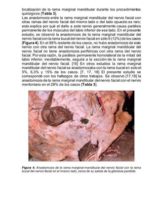 ANATOMIA QUIRURGICA DE LA RAMA MARGINAL MANDIBULAR DEL NERVIO FACIAL | DOCX