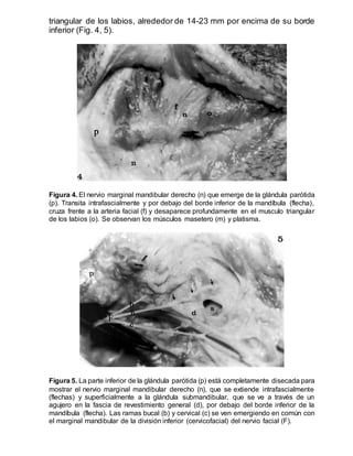 ANATOMIA QUIRURGICA DE LA RAMA MARGINAL MANDIBULAR DEL NERVIO FACIAL | DOCX