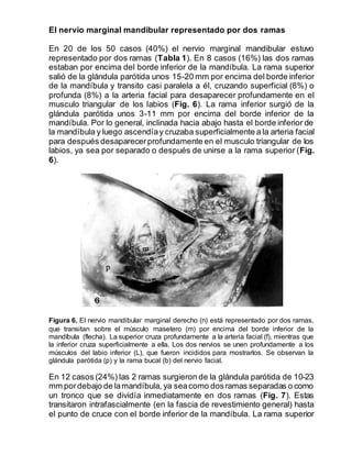ANATOMIA QUIRURGICA DE LA RAMA MARGINAL MANDIBULAR DEL NERVIO FACIAL | DOCX
