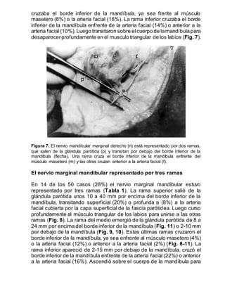ANATOMIA QUIRURGICA DE LA RAMA MARGINAL MANDIBULAR DEL NERVIO FACIAL | DOCX