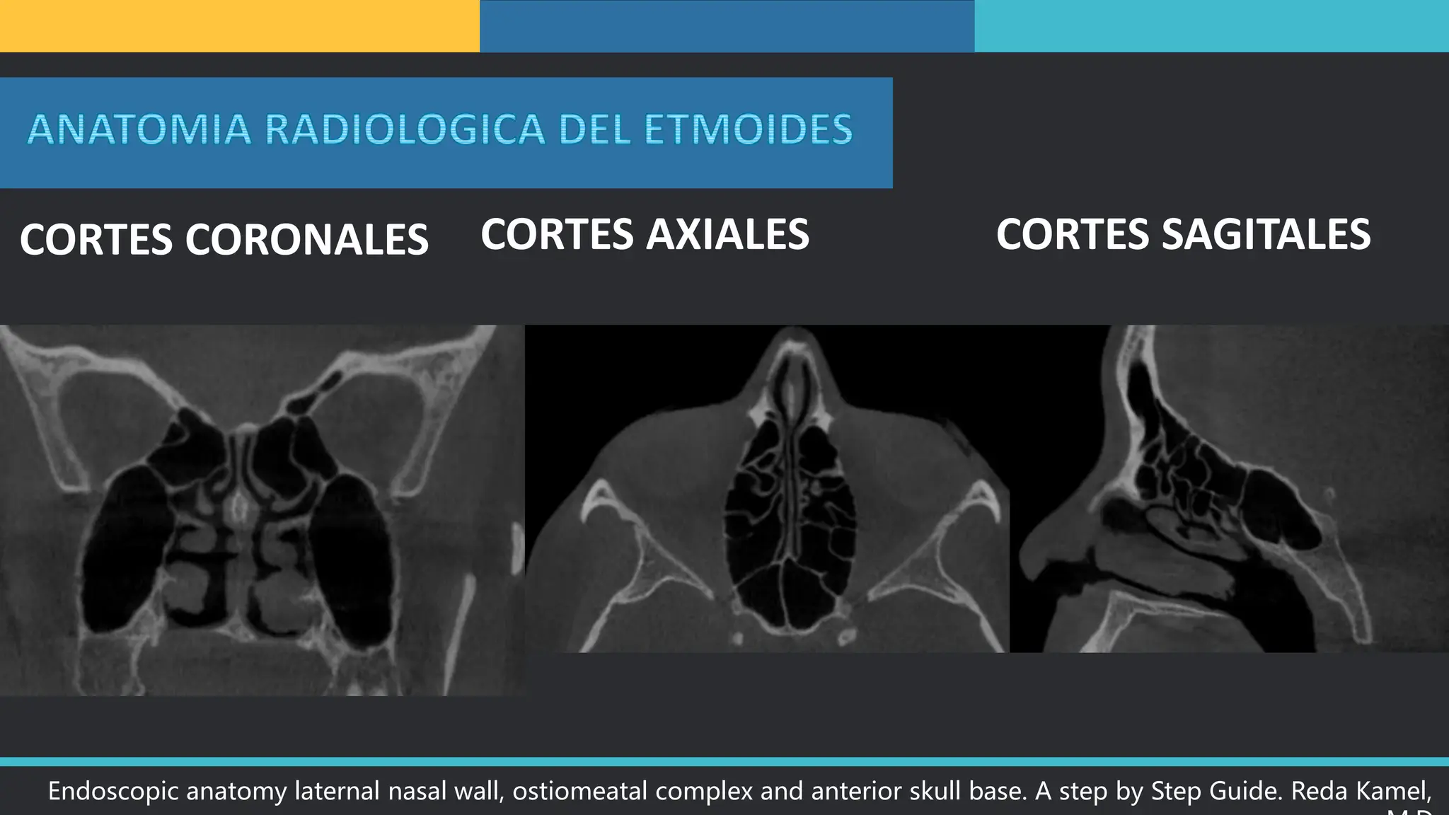 Anatomia quirurgica de Senos paranasales Lismary fellow 2.pptx