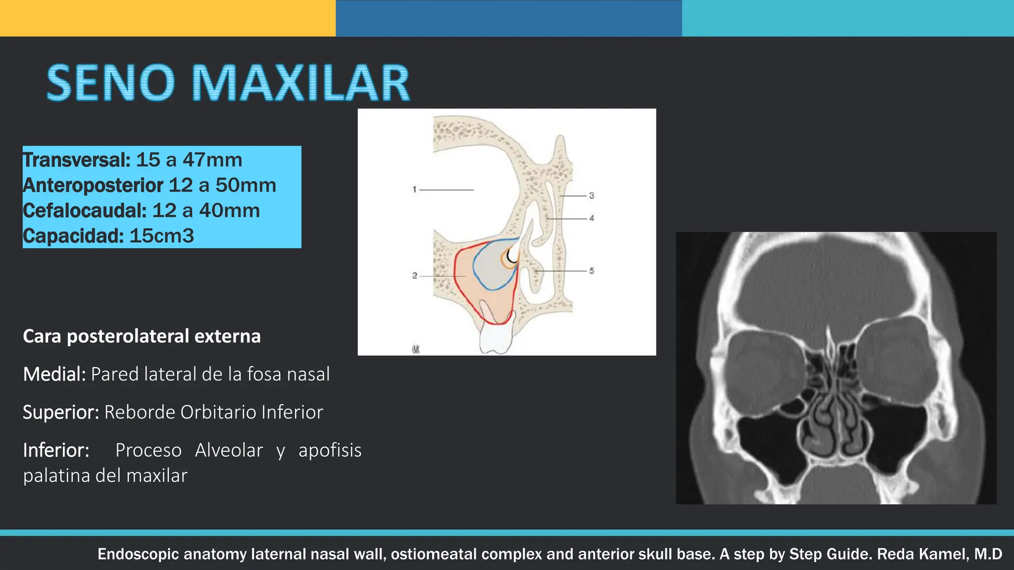 Anatomia quirurgica de Senos paranasales Lismary fellow 2.pptx