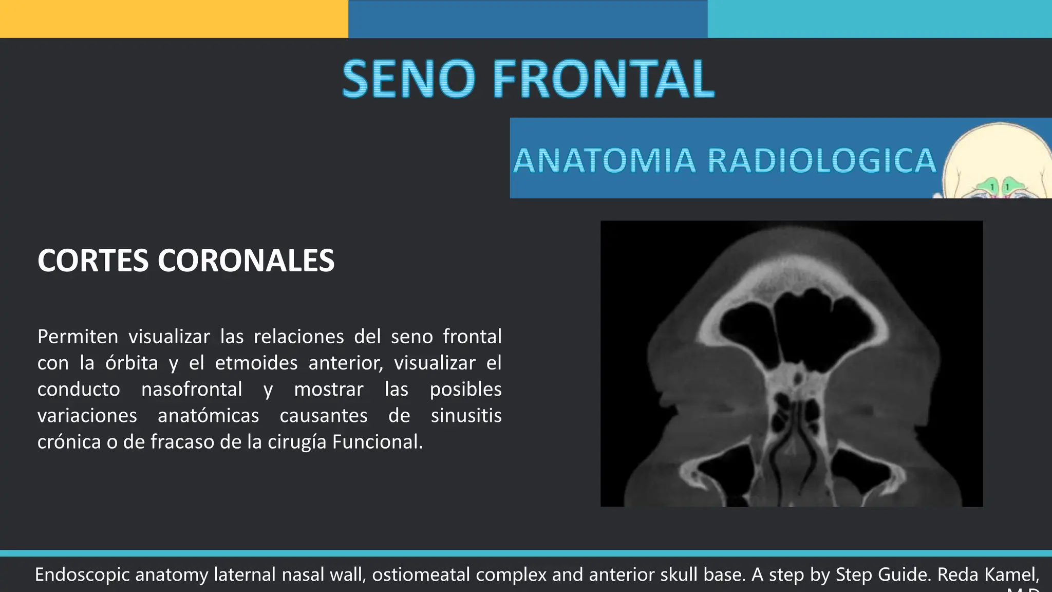 Anatomia quirurgica de Senos paranasales Lismary fellow 2.pptx