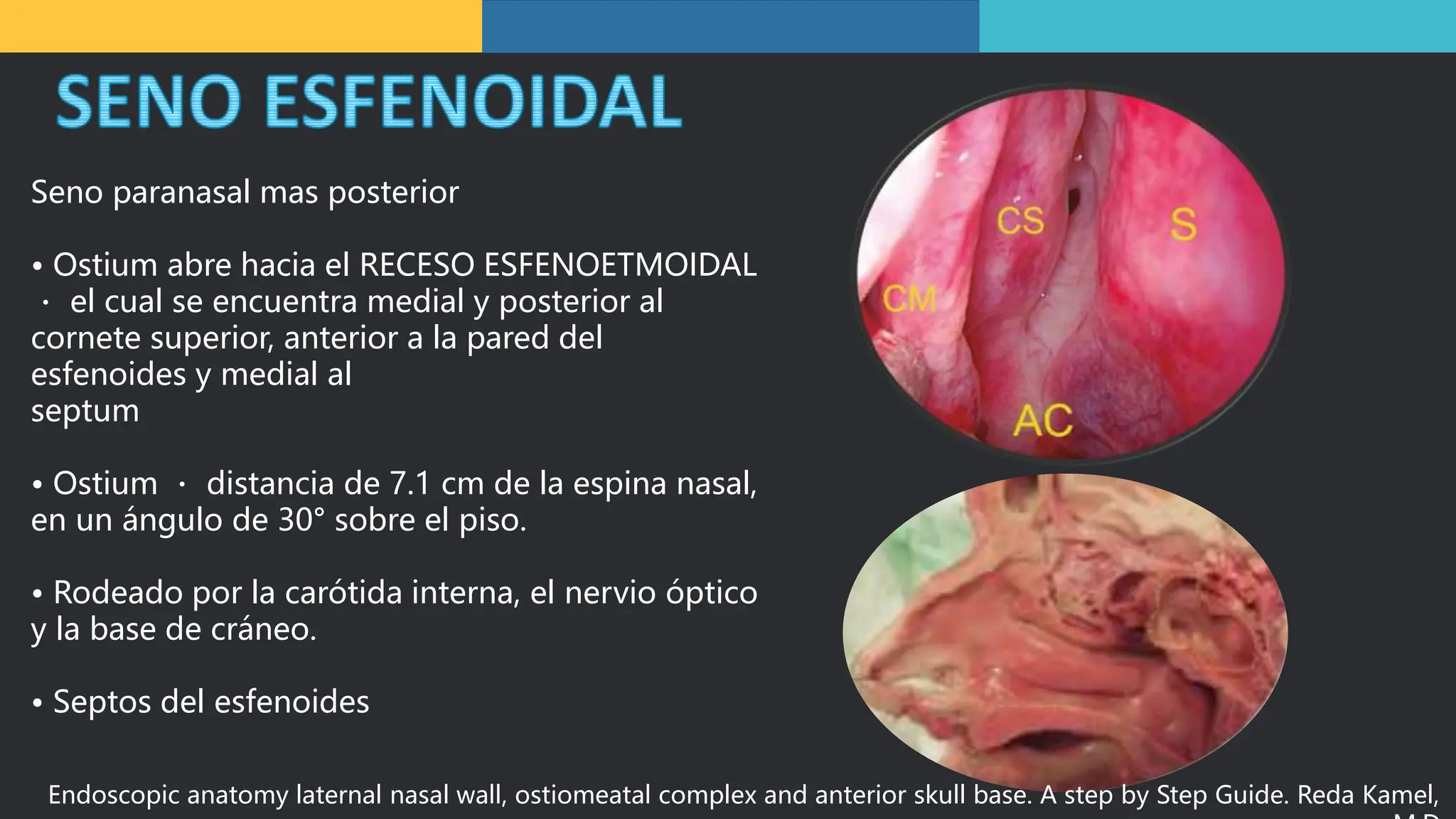 Anatomia quirurgica de Senos paranasales Lismary fellow 2.pptx