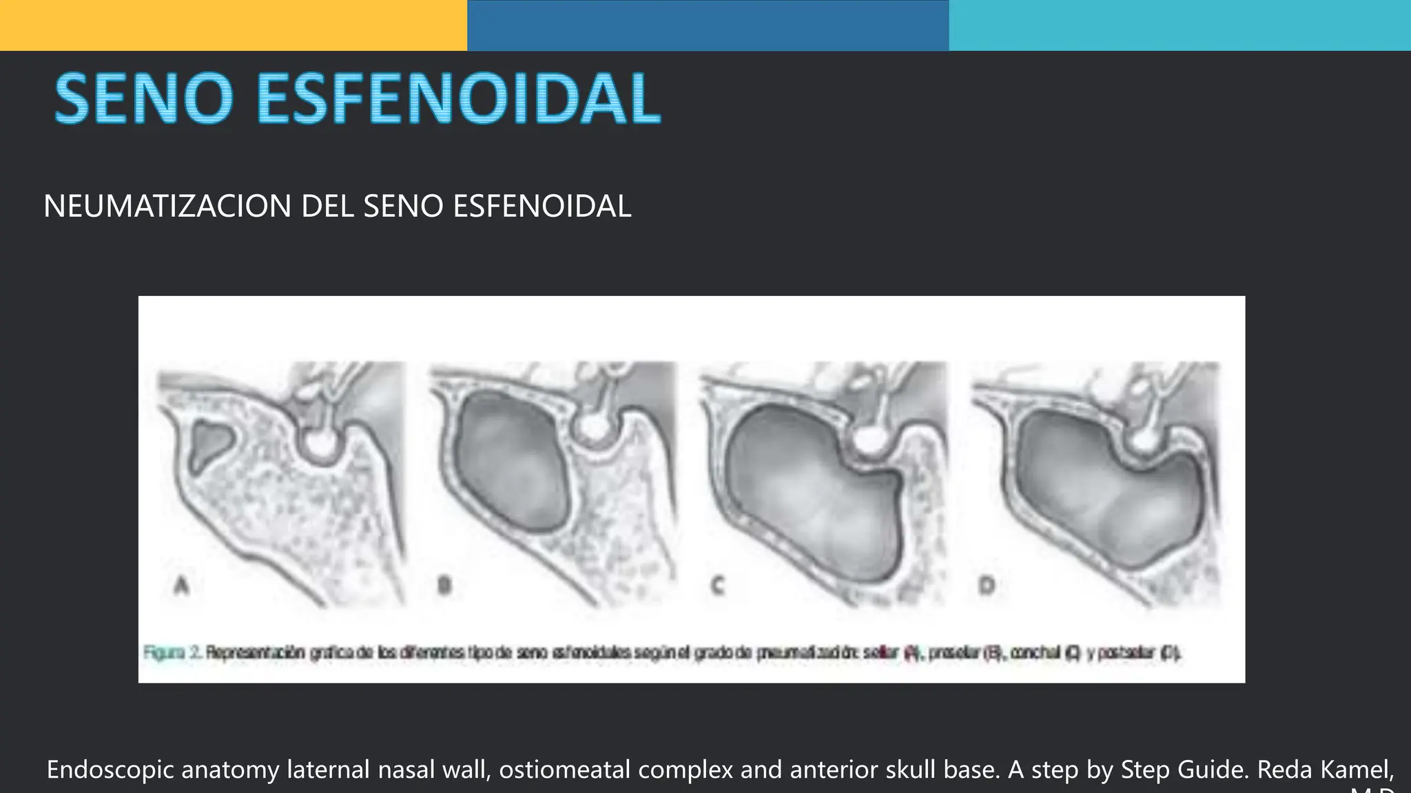 Anatomia quirurgica de Senos paranasales Lismary fellow 2.pptx