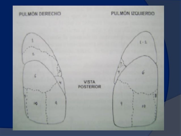 Anatomia quirurgica PULMONAR .pdf