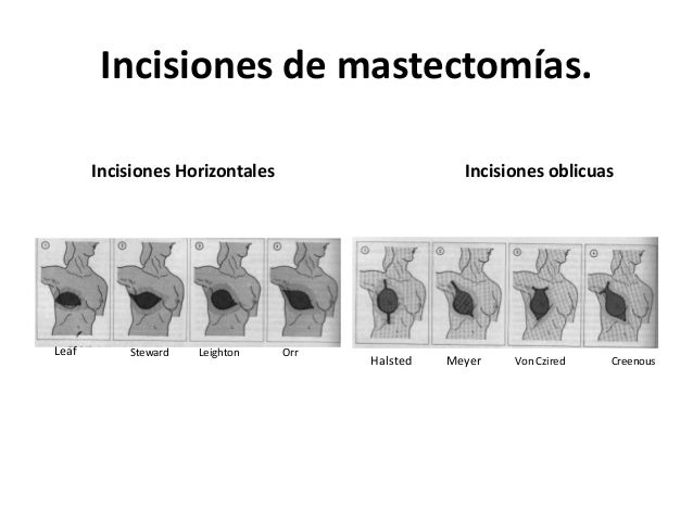 Anatomia qx de la mama