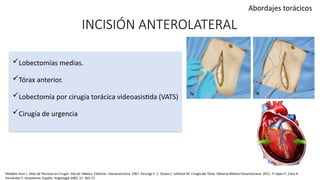 ANATOMIA Quirúrgica DE TÓRAX manejo .pptx