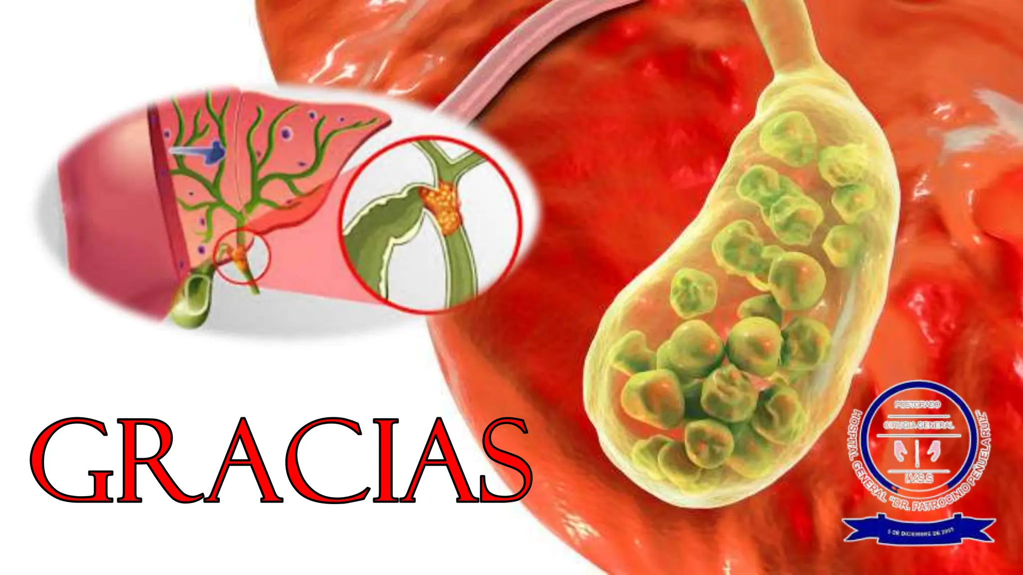 ANATOMIA VESICULA BILIAR y VÍAS BILIARES.pptx