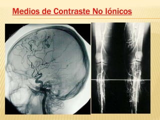 Anatomia radio. ii contrastes | PPTX